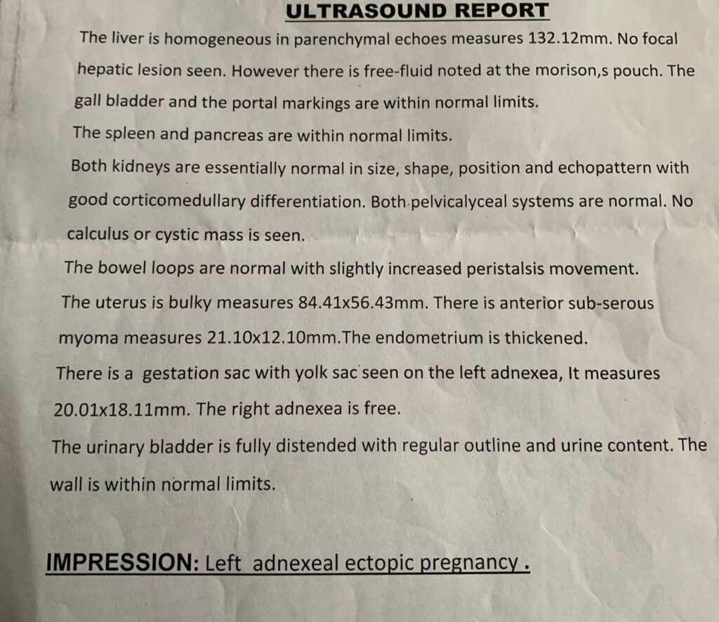 Case Report Acute Urinary Retention In An Interstitial Ectopic Pregnancy